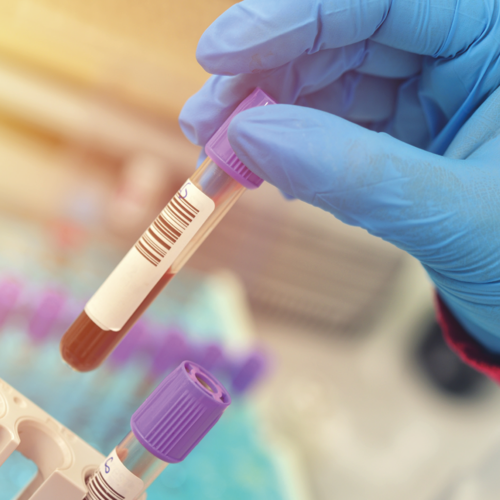 Toma de muestra - Dicipa